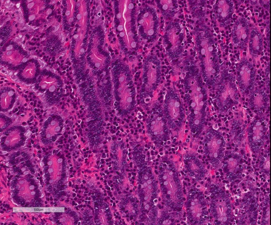 British Society of Toxicological Pathology » Intestine