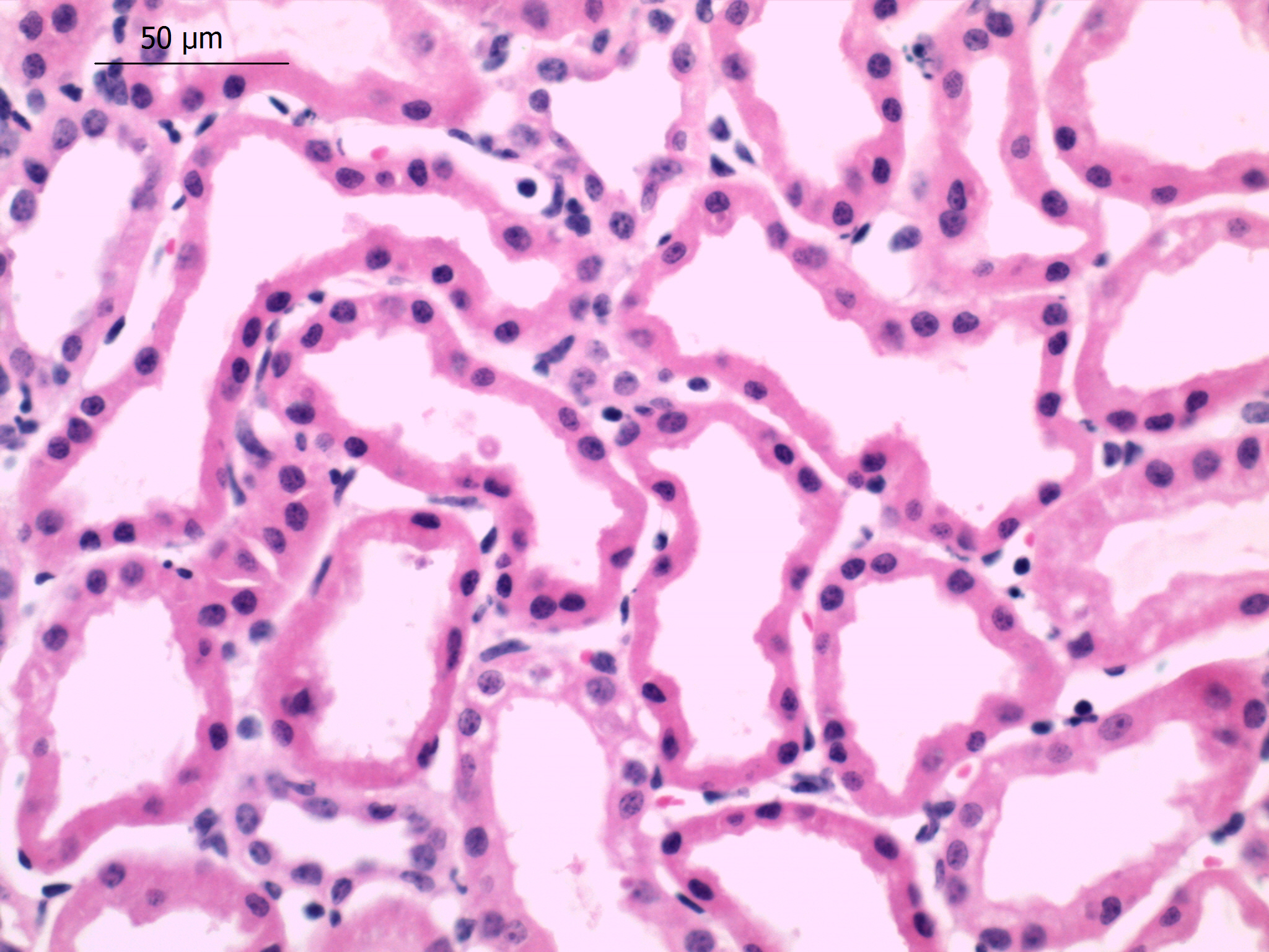 British Society of Toxicological Pathology » Kidney H&E