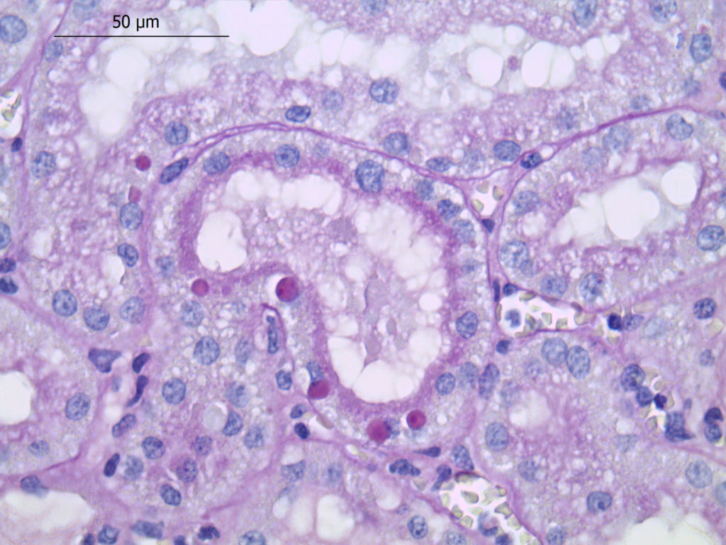 British Society of Toxicological Pathology » Kidney PAS