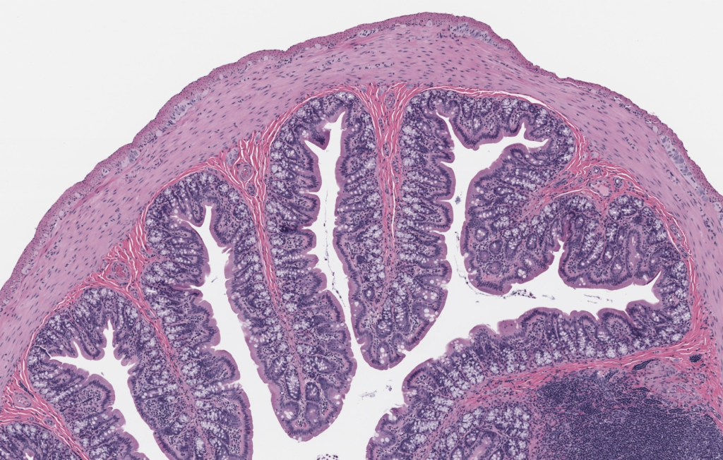 British Society of Toxicological Pathology » CES 9: Digestive System